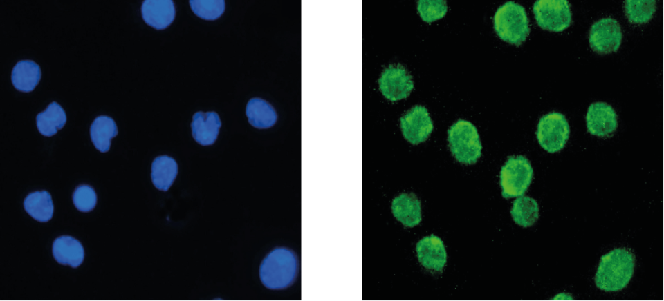 Shi-fix Coverslips – shikharbiotech.com